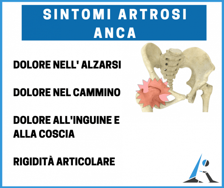 Artrosi dell' anca (coxartrosi): quali sono i sintomi e quali le cure