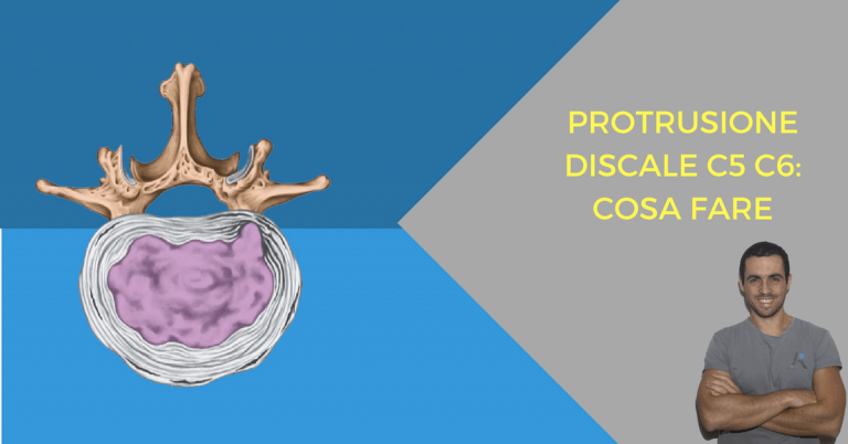 Cos'è e cosa fare se hai una protrusione (o discopatia) C5-C6 o C6-C7 ...