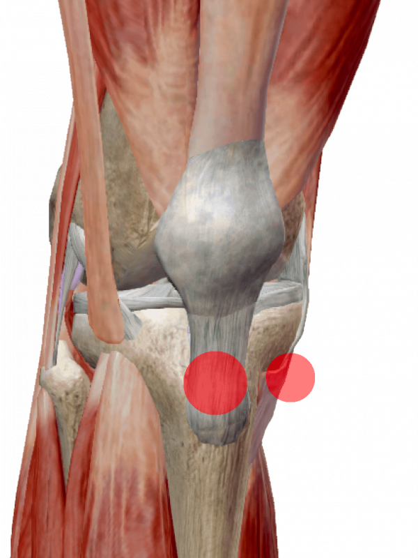Dolore del ginocchio nella corsa: cause e cure