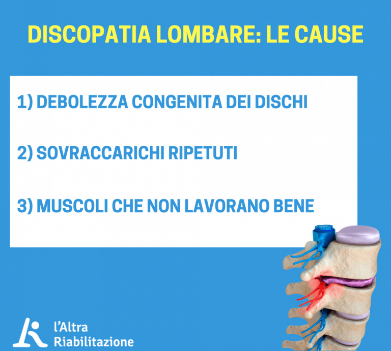 Discopatia L5-S1 (o protrusione discale L5-S1): sintomi ed esercizi - L ...