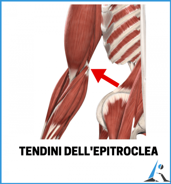 Vinci la "battaglia" contro l'EPITROCLEITE: guida completa