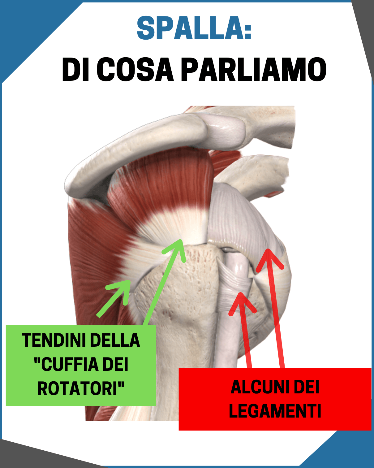 Dolore alla spalla: quando serve l'intervento chirurgico