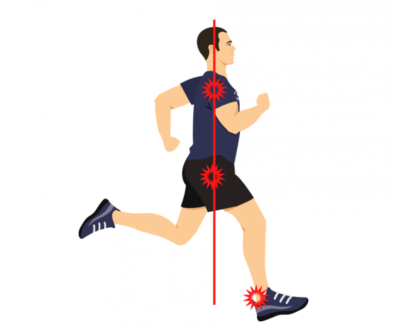 Sindrome della bandelletta ileotibiale: la guida completa