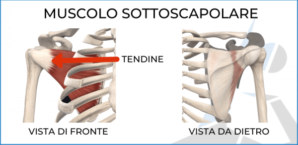 Infiammazione (o lesione) al tendine del sottoscapolare: i rimedi più ...