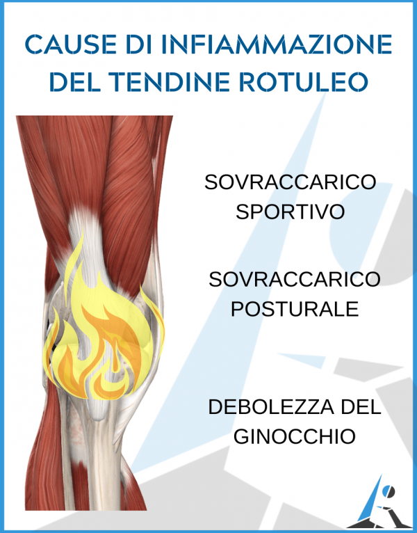 Infiammazione tendine rotuleo: risolvila in 3 passaggi