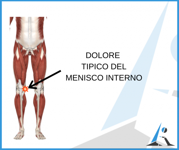 Menisco interno: cosa fare se hai una lesione o una meniscosi - L'Altra ...