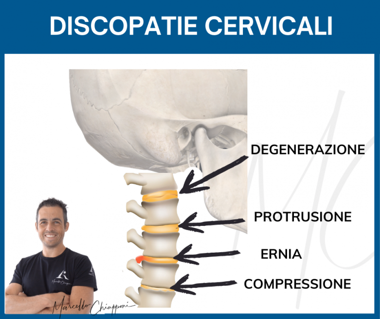 Risonanza magnetica cervicale: un esame inutile?