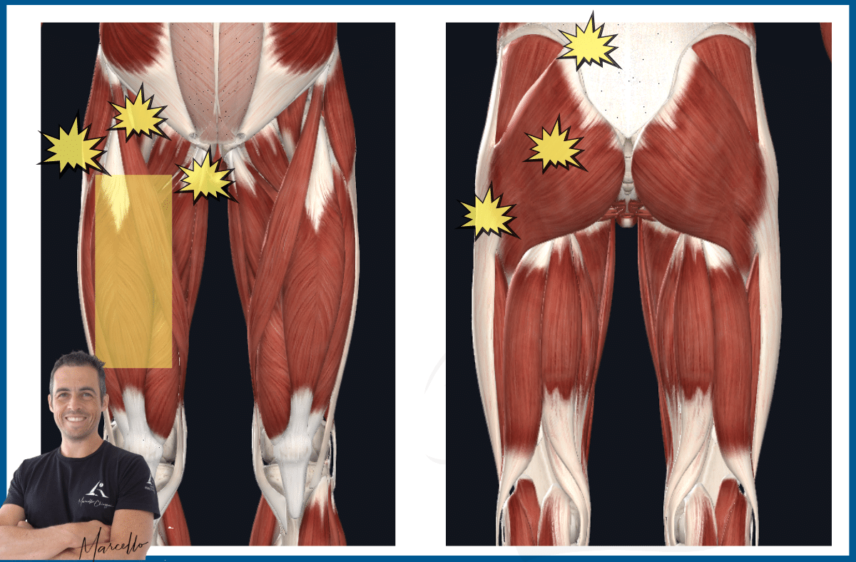 Il dolore all' anca - L'Altra Riabilitazione
