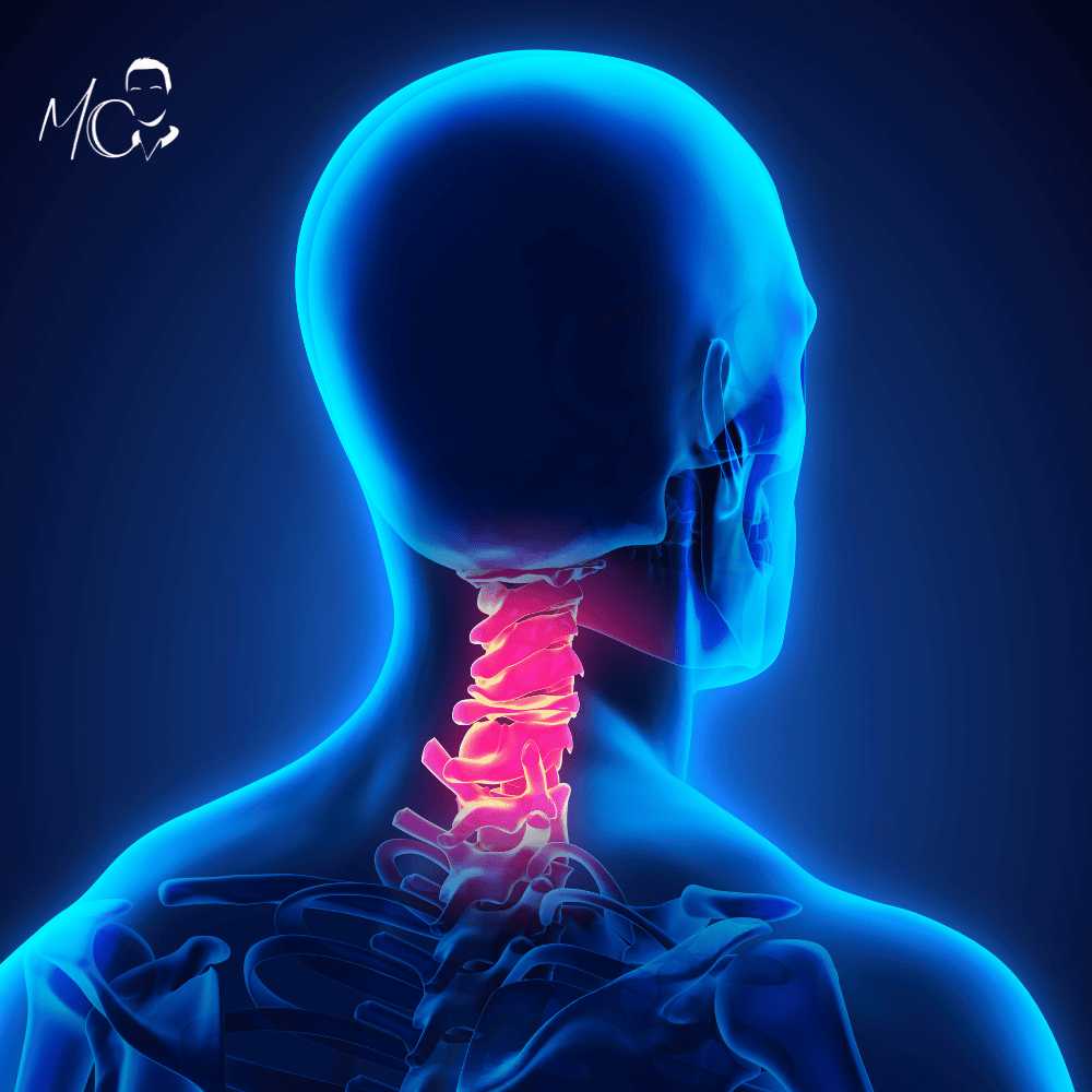 Spondilosi cervicale: cos'è e come risolverla (si può!)