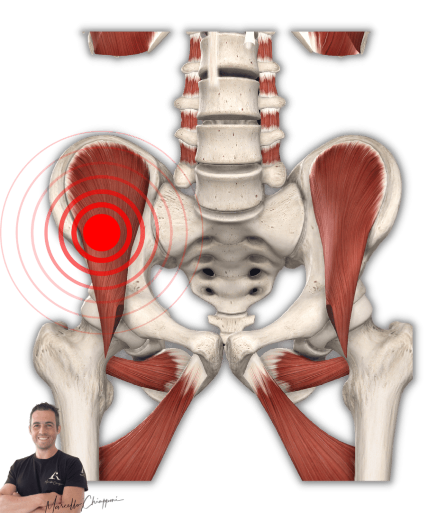 Dolore anca destra: ecco le 2 possibili cause