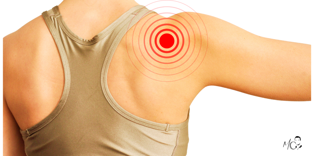 Sublussazione della spalla: ecco cosa fare (sintomi e cura)