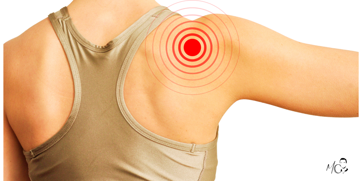 Sublussazione della spalla: ecco cosa fare (sintomi e cura)