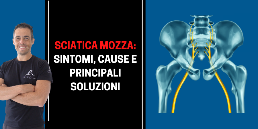 Sciatica mozza: sintomi, cause e principali soluzioni