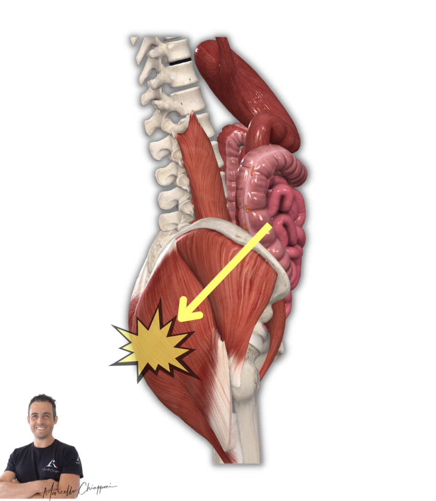 Dolore gluteo destro: perché non passa mai?