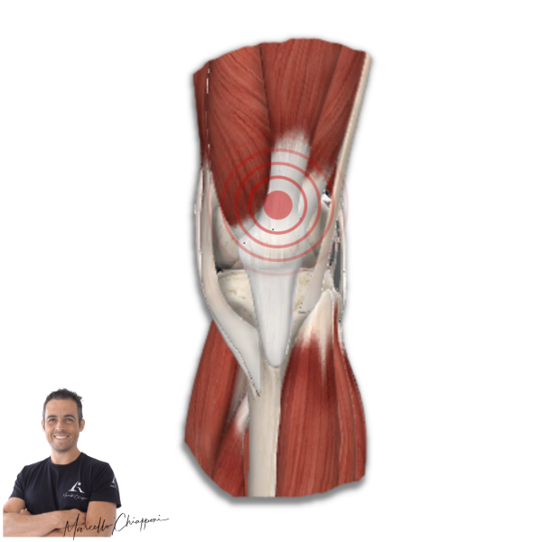 Dolore al ginocchio: scopri il tuo problema dai sintomi!