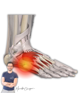 Dolore al piede: punti critici, cause e rimedi "muscolari"