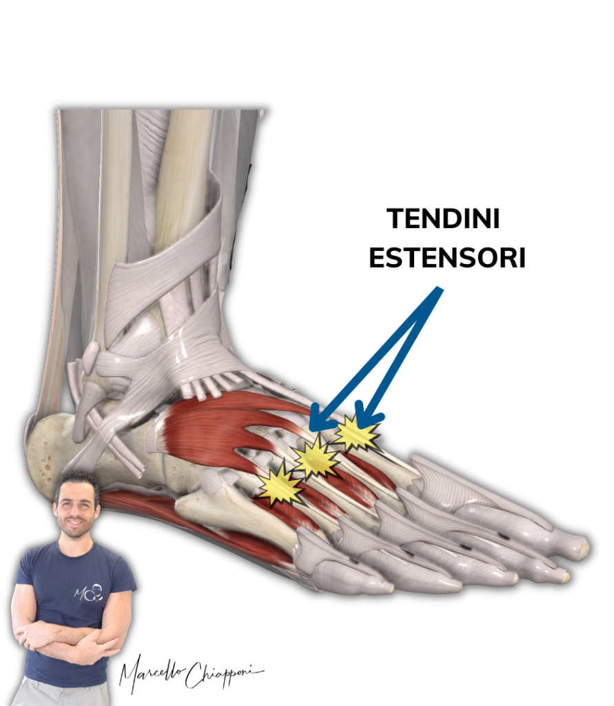 Dolore al piede: punti critici, cause e rimedi "muscolari"