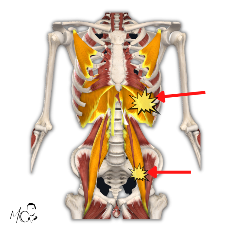 Psoas infiammato e ansia: il legame tra muscolo e salute mentale Psoas infiammato e ansia: il legame tra muscolo e salute mentale